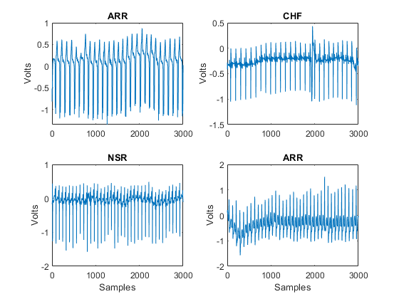 Análisis de series temporales: pasos, tipos y ejemplos - MATLAB & Simulink